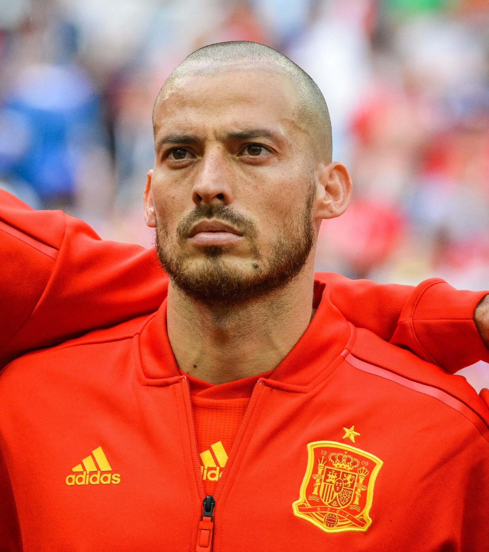 Steve Carell Hair Transplant: Before, After, and His New Hairline