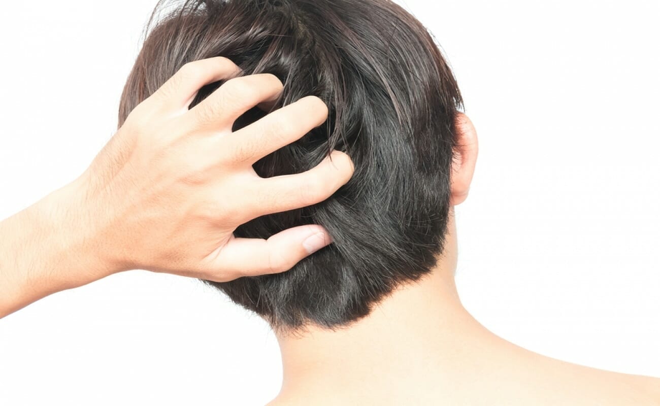 Why Is My Hair Itching After A Hair Transplant?