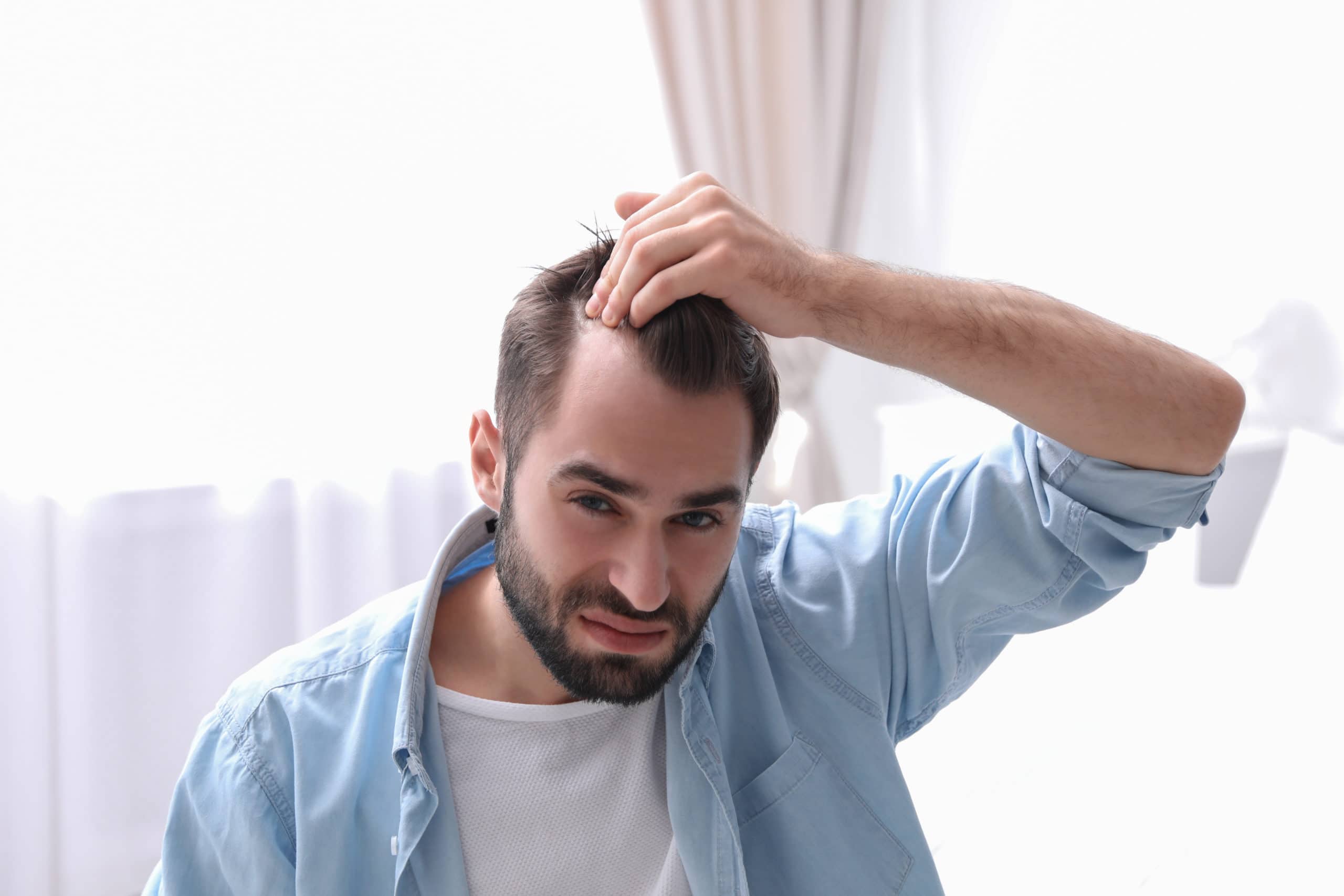 Unshaven Fue Hair Transplant Ufue The Treatment Rooms London